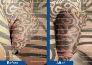 About Loria Medical Center NYC | Dr. Victor Loria - ☎ 877-425-2165